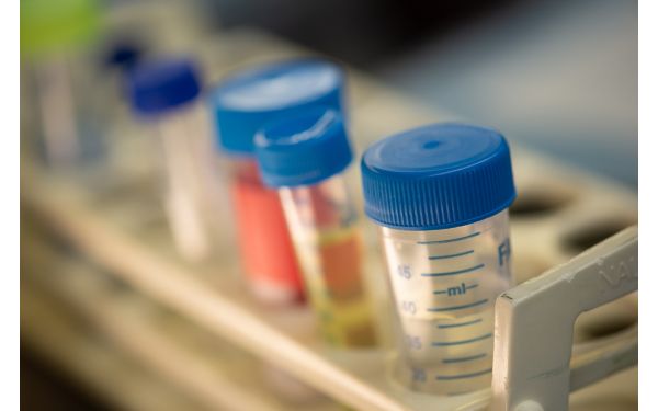 Labs | St. Jude Research