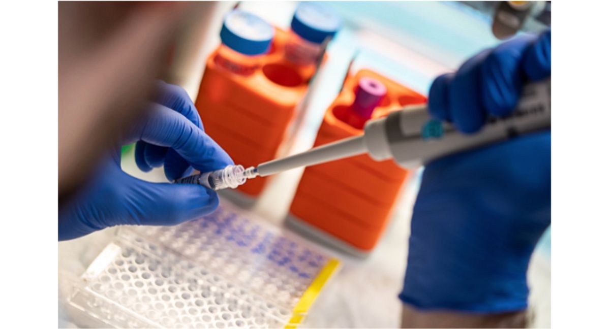 Human leukocyte antigen B (HLA-B) 57:01 | St. Jude Research