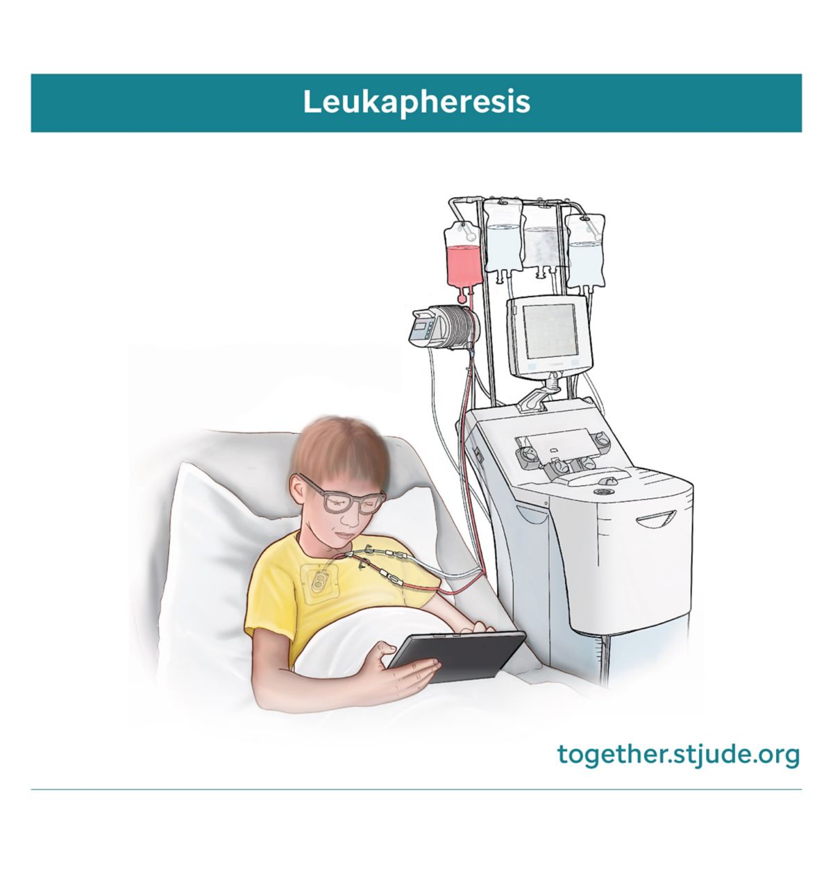 Leukapheresis - Together by St. Jude™