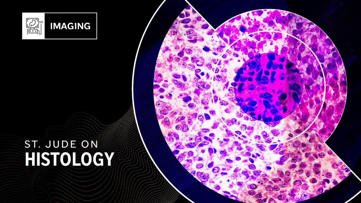 Histology detectives magnify the clinical and research mission of St ...