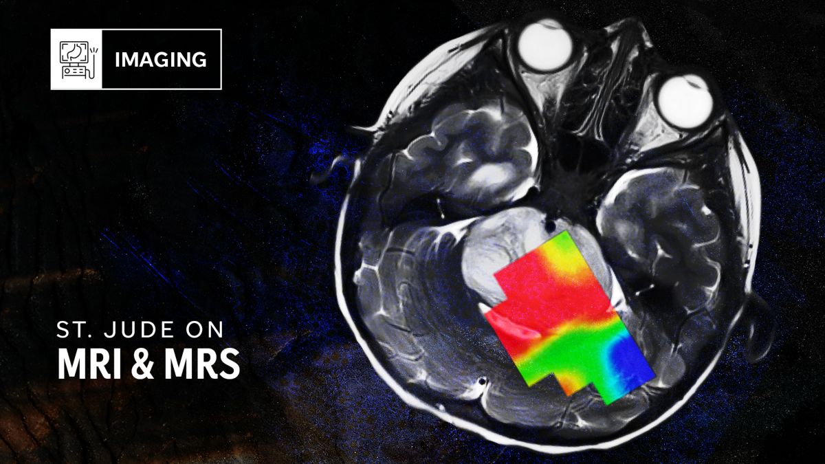 Imaging provides a front row seat to metabolic reactions | St. Jude ...
